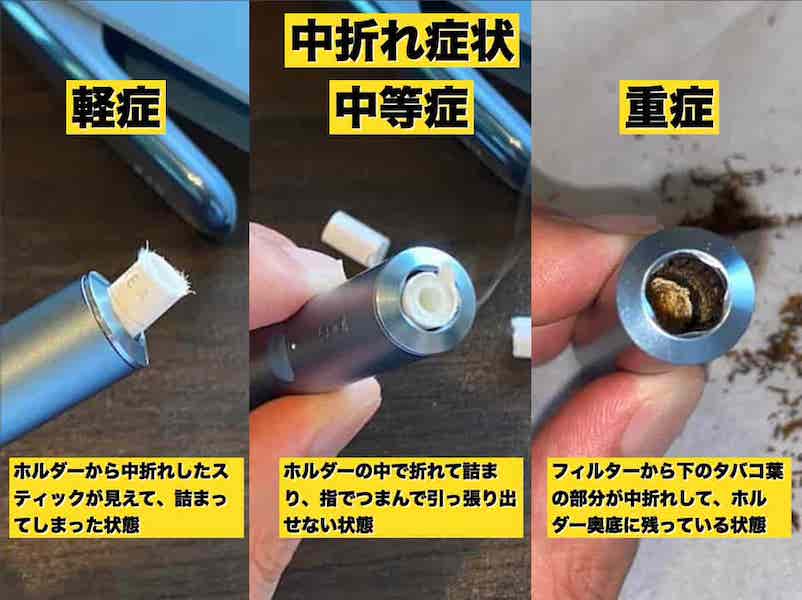 【販売中!】TRUN(トゥルン)はアイコスやグローの詰まりや中折れを5秒で解決！使い方やメリットを徹底レビュー！－リラゾ(relazo)